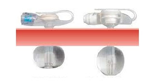 G-tubes - Buttons - NG Tubes – Tubie-Care : Discount Feeding & Home ...